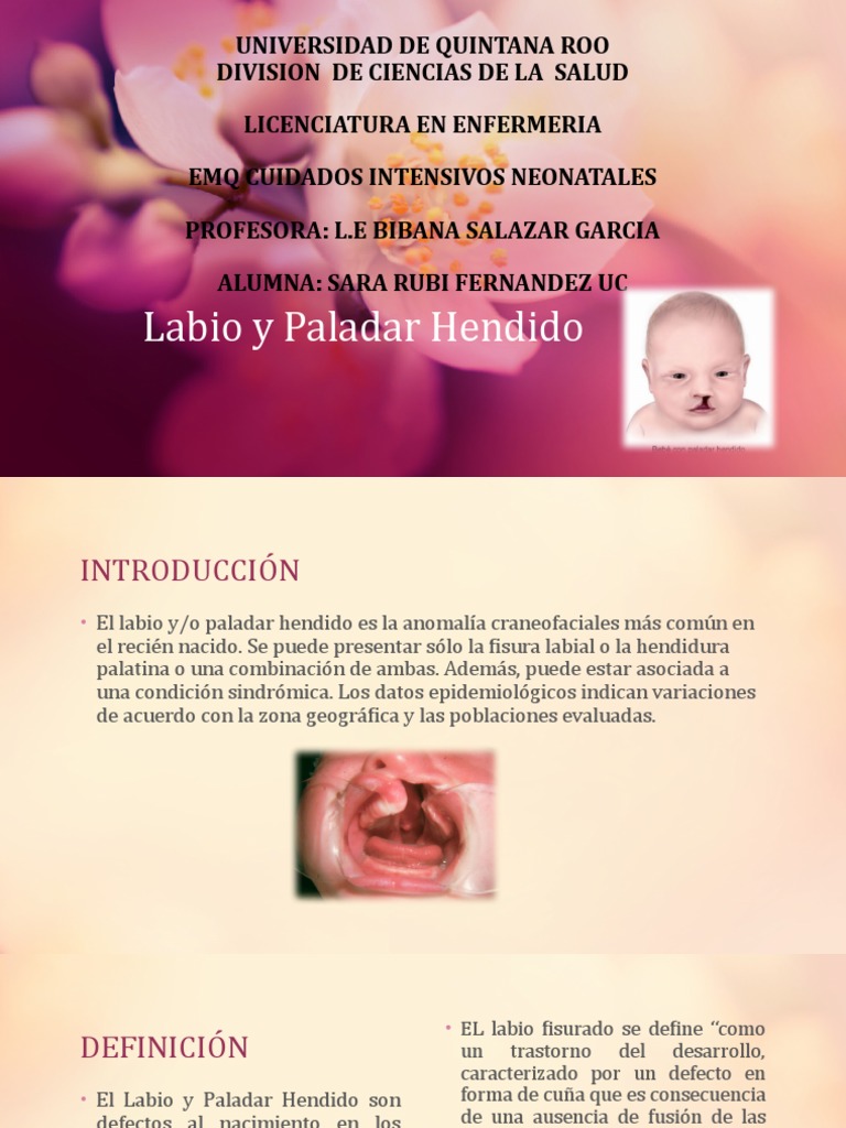 Labio y Paladar Hendido Sara | PDF | Especialidades Medicas | Medicina ...