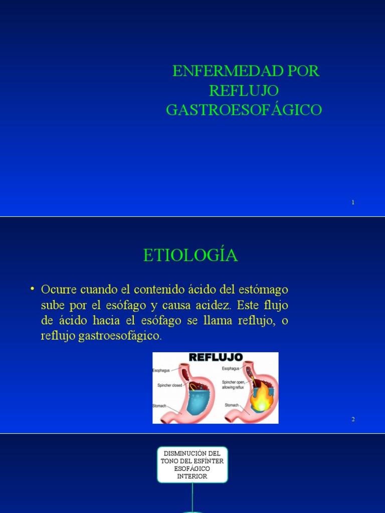 Enfermedad Por Reflujo Gastroesofagico | PDF | La enfermedad por ...