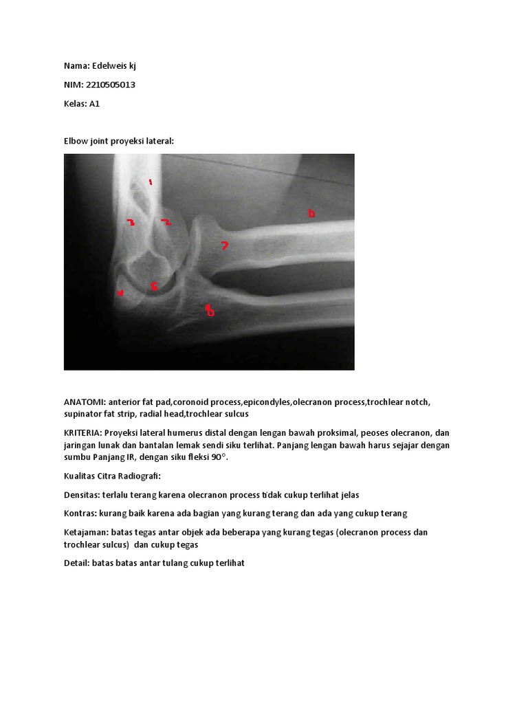Proyeksi Lateral Elbow Joint dan Olecranon | PDF