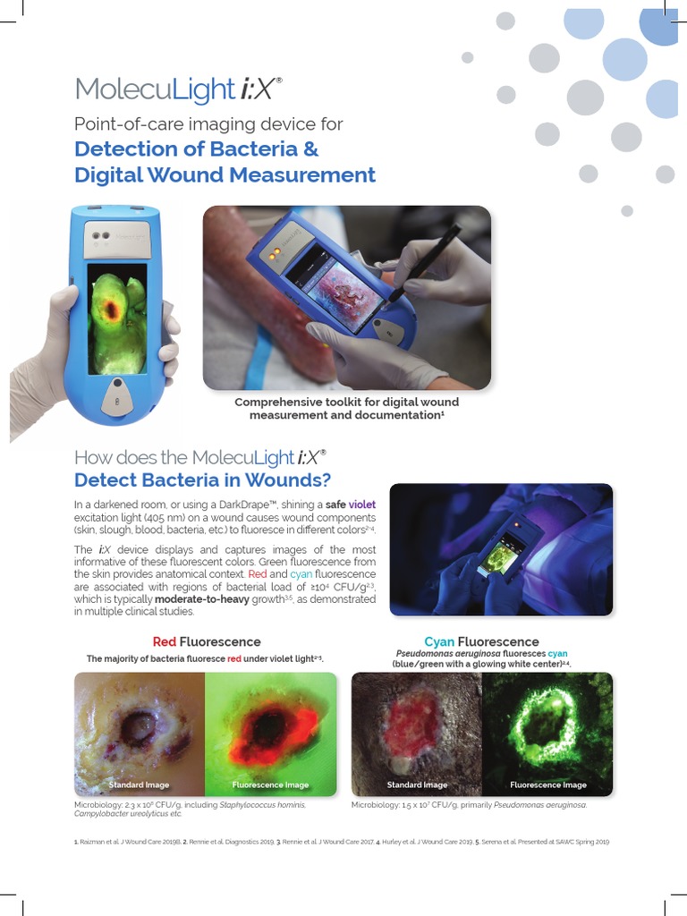 PN 1781 MolecuLight Overview Flyer A4 PRINT | PDF | Wound | Fluorescence