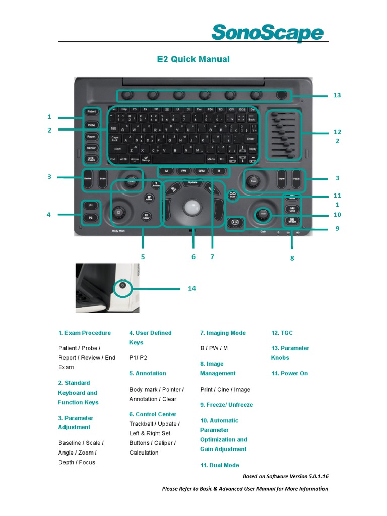Sonoscape E2 Quick Manual | PDF | Computer Keyboard | Computer Monitor Sonoscape E2 Quick Manual | PDF | Computer Keyboard | Computer Monitor