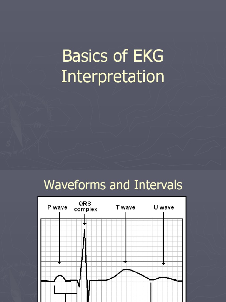 Basics of EKG Interpretation | PDF | Electrocardiography | Thorax ...