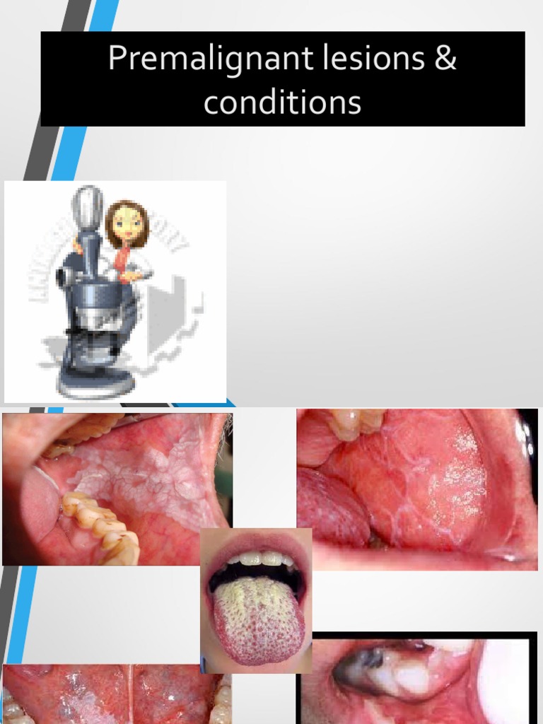 Premalignant Lesions & Conditions | PDF | Anatomy | Medical Specialties