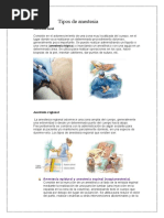 Posición de Roser o Proetz | PDF | Inflamación | Biología Celular)