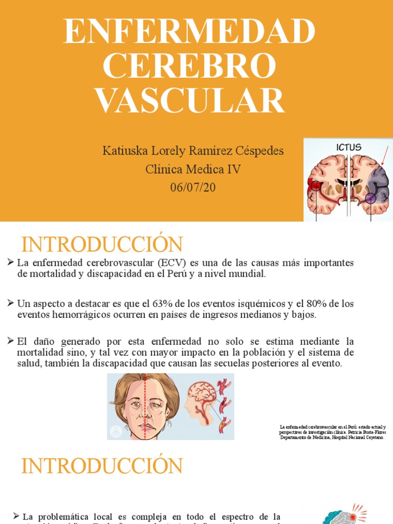 Enfermedad Cerebro Vascular Isquemico | Descargar gratis PDF | Carrera | Isquemia