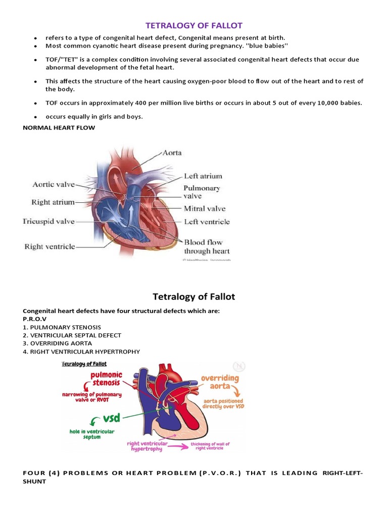 Tetralogy of Fallot: Key Defects Explained | PDF | Congenital Heart ...