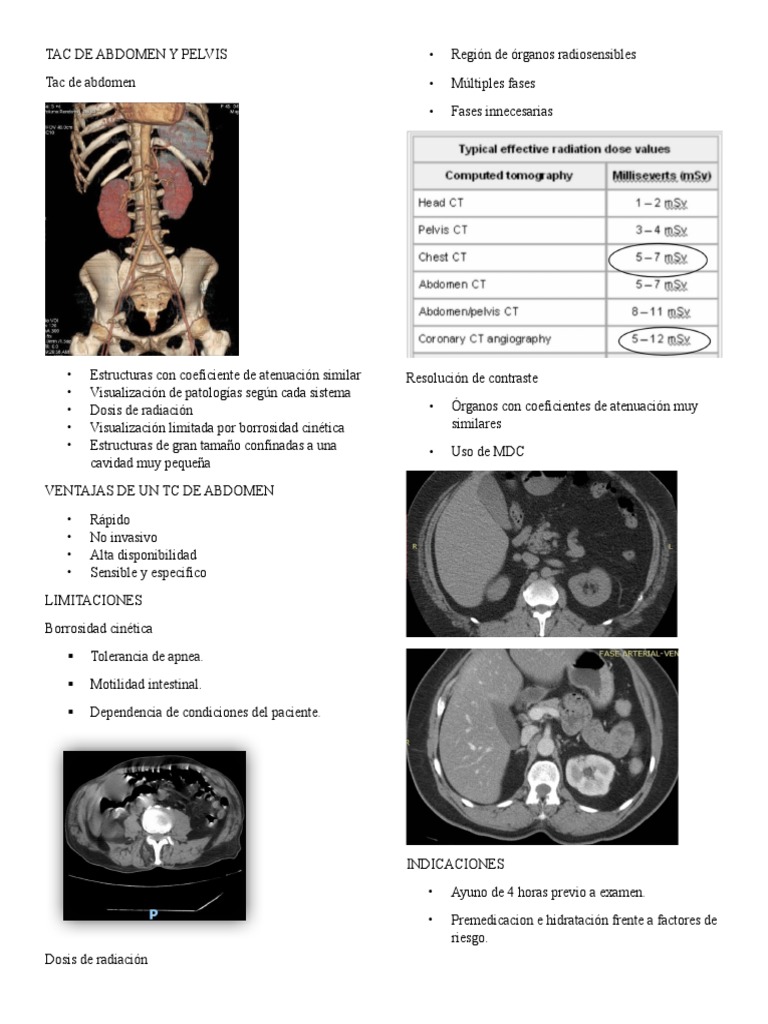 Abdomen Tac | PDF | Cirrosis | Hígado