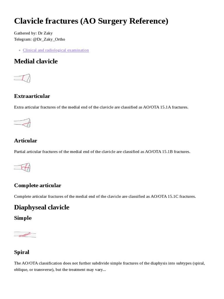 Clavicle AO Surgery Reference (2023) | PDF | Anatomical Terms Of Motion | Shoulder