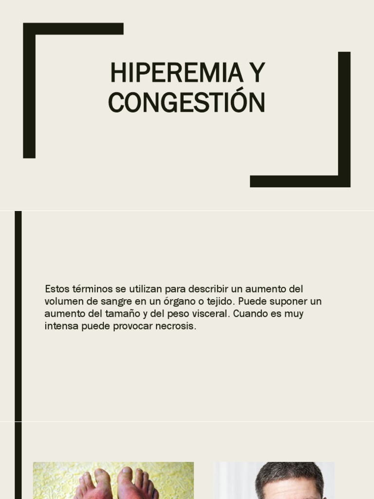 Hiperemia y Congestión: Patologías Clave | PDF | Vena | Sistema ...