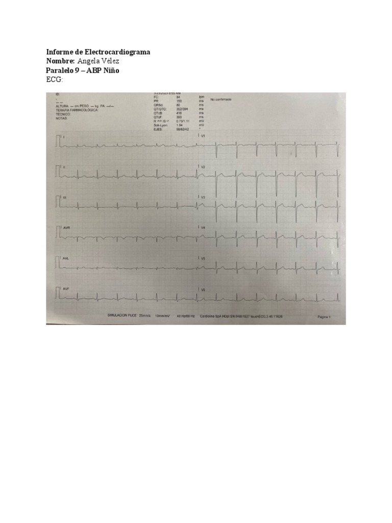 Informe de Electrocardiograma | PDF | Electrocardiografia | Imagenes ...