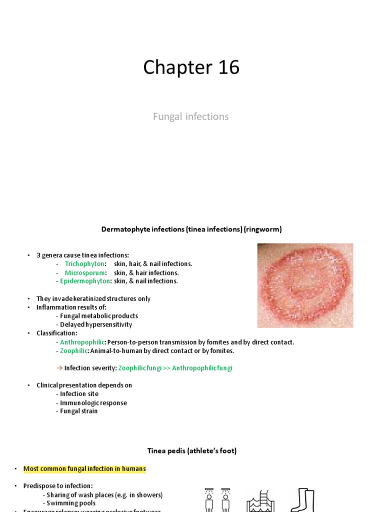 Fungal Infections - Infestations | PDF | Clinical Medicine | Medical ...