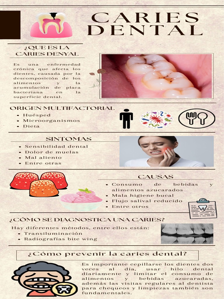 Caries Dental | PDF