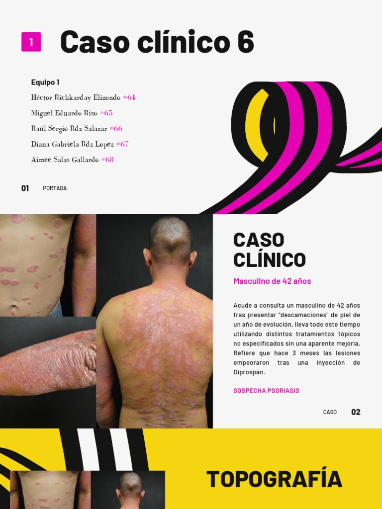 Derma Equipo 1 - Psoriasis | PDF | Psoriasis | Especialidades Medicas