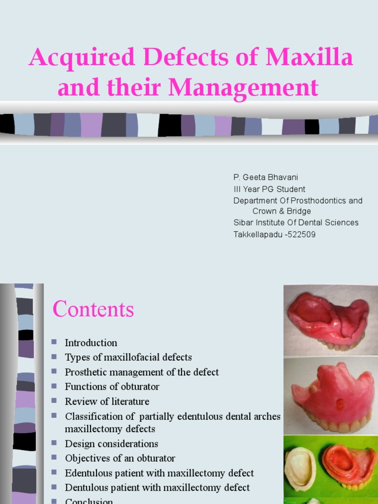Acquired Defects of Maxilla and Management | PDF | Dentures ...