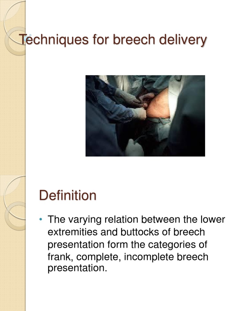 Breech Delivery | PDF