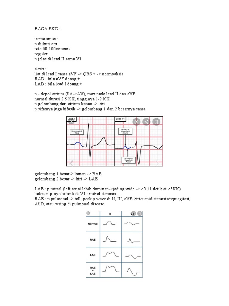 Interpretasi EKG dan Aksis Jantung | PDF