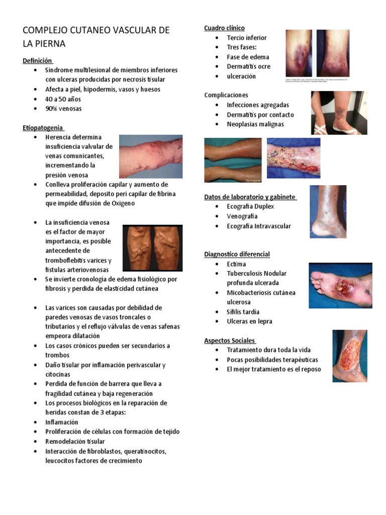 Complejo Cutaneo Vascular de La Pierna | PDF | Inflamación | Edema
