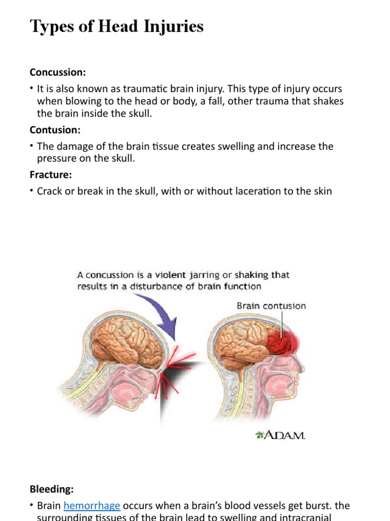 Types of Head Injuries: Concussion | PDF | Traumatic Brain Injury | Injury