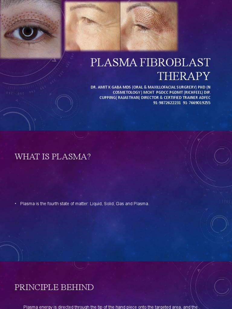 Plasma Fibroblast Therapy | PDF | Scar | Clinical Medicine