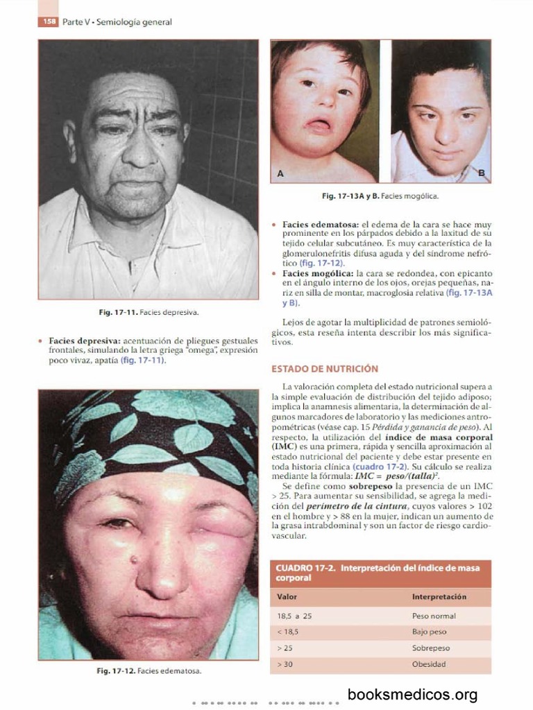 G.peso, Cabeza y Cuello | PDF | Edema | Obesidad