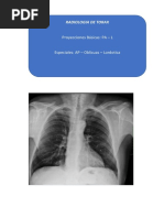 Proyeccion AP Lordotica | PDF | Pulmón | Hombro