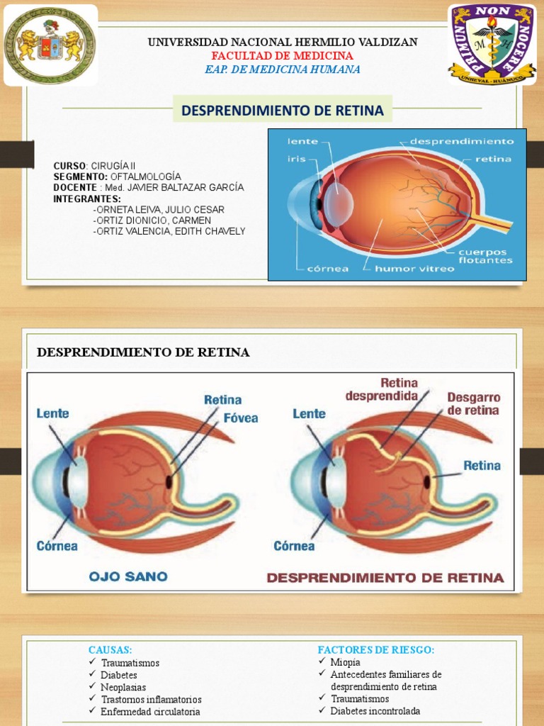 Desprendimiento de Retina | PDF | Epidemiología | Medicina
