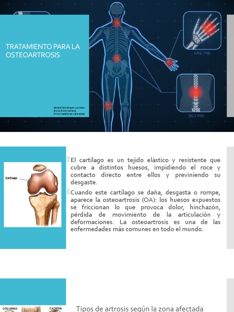 OSTEOARTROSIS | PDF | Osteoartritis | Rodilla