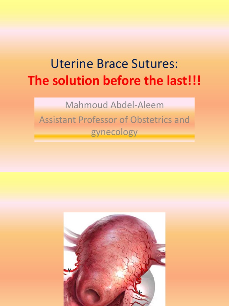 Uterine Brace Sutures for PPH Management | PDF | Uterus | Surgical Suture