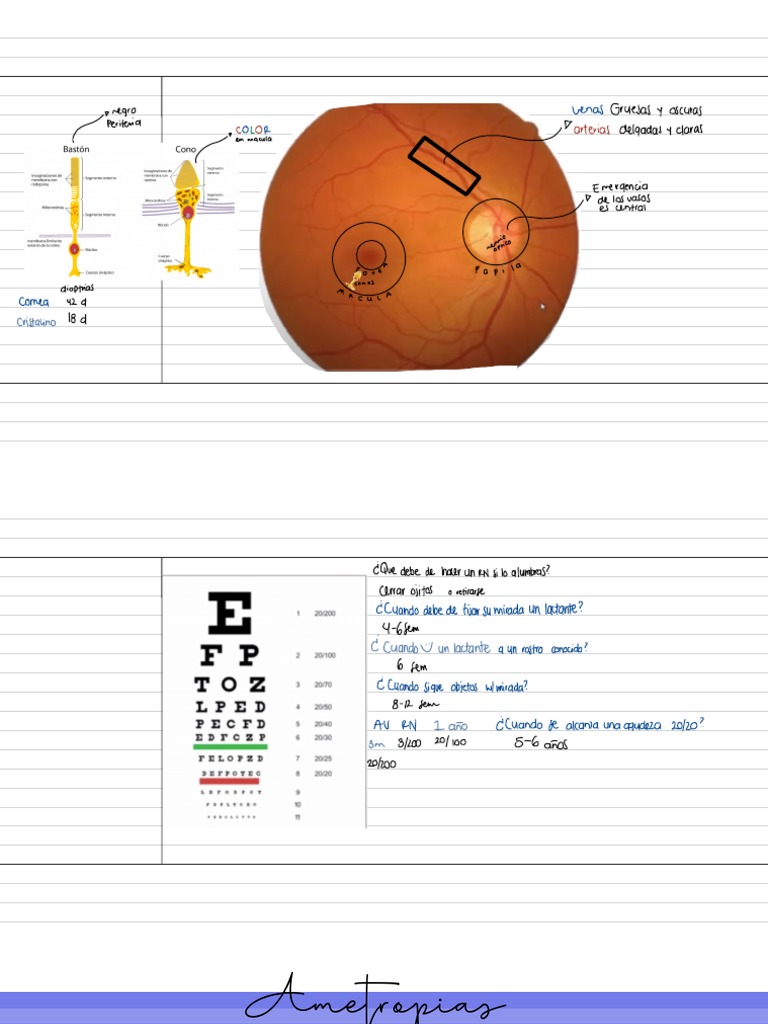 Oftalmologia | PDF | Glaucoma | Ojo humano