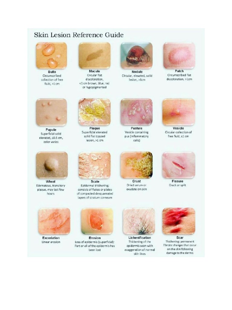 Skin Lesion Types 06-2023 | PDF