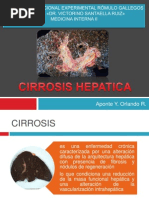 Fisiopatologia de La Cirrosis Hepatica | PDF | Cirrosis | Hígado