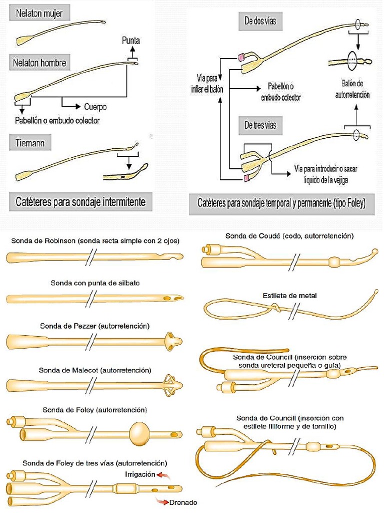 Tipos de Sondas | PDF