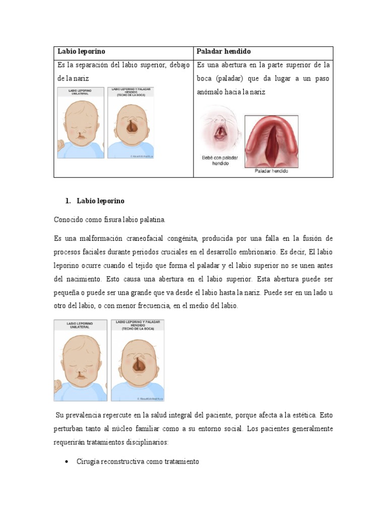 Labio Leporino | PDF | Medicina | Medicina CLINICA