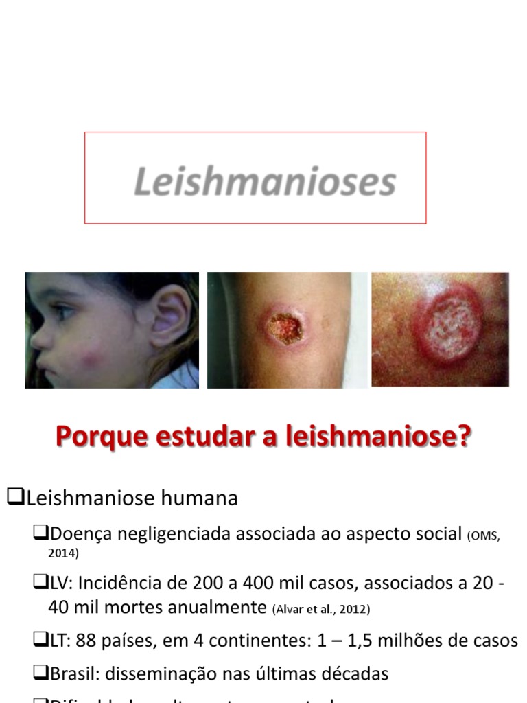 05 Leishmanioses | PDF | Leishmania | Especialidades médicas