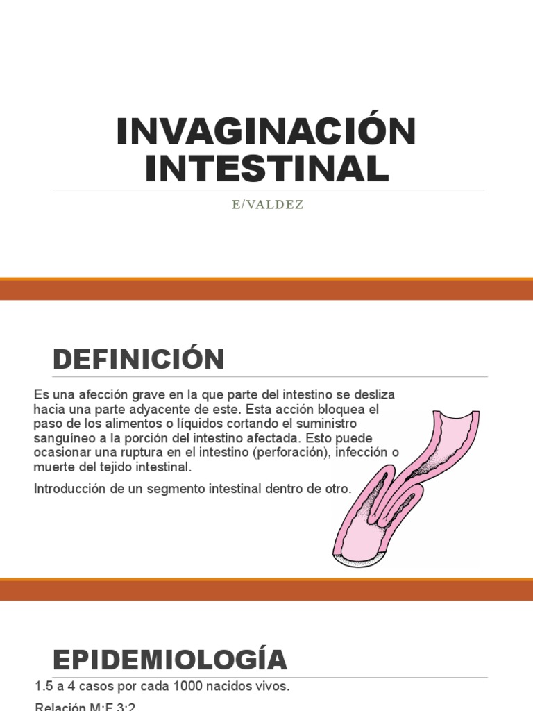 Invaginación Intestinal | PDF | Abdomen | Intestino delgado