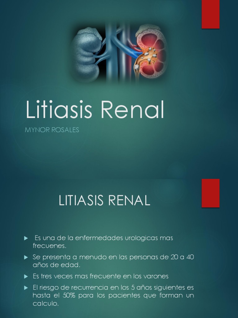 Litiasis Renal | PDF | Especialidades Medicas | Medicina CLINICA