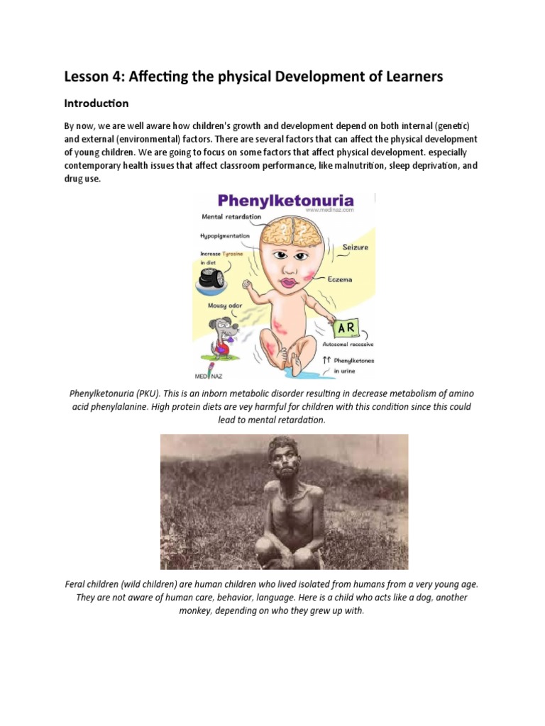 Factors Influencing Children's Physical Growth | PDF | Malnutrition ...