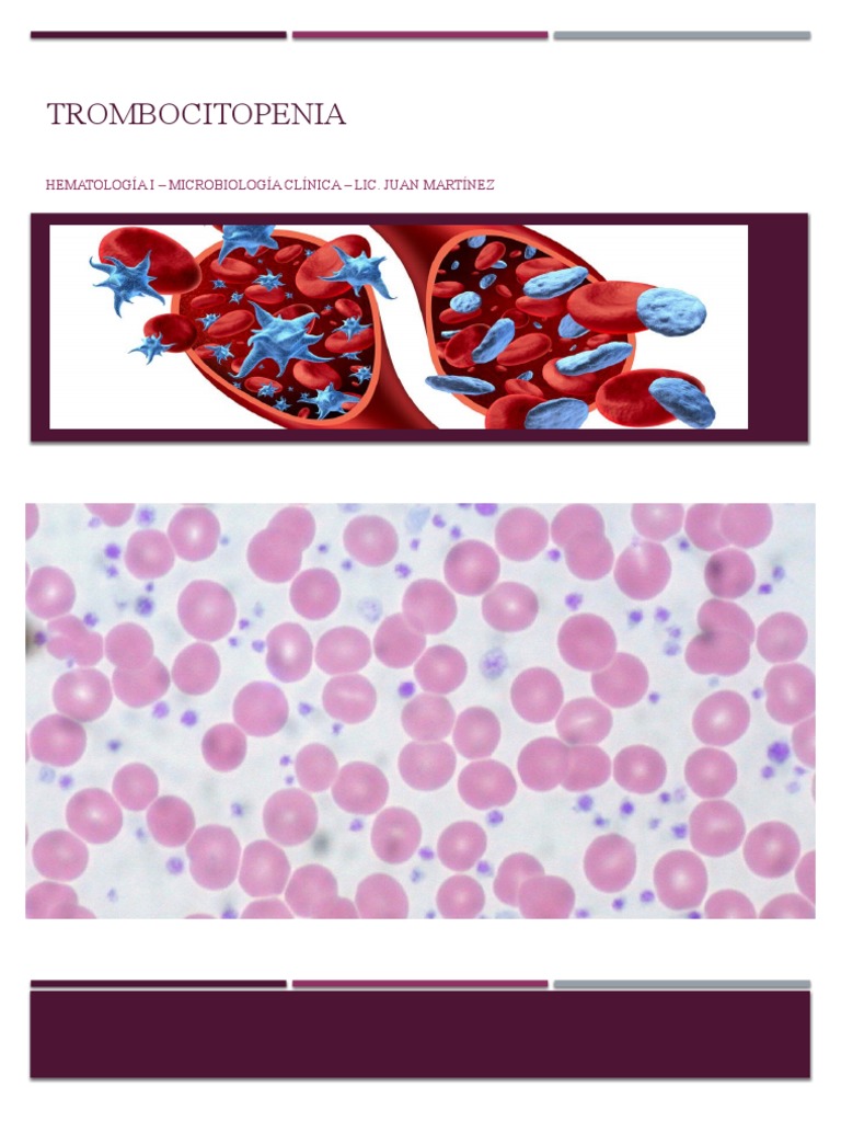 Trombocitopenia | PDF | Plaqueta | Sangre
