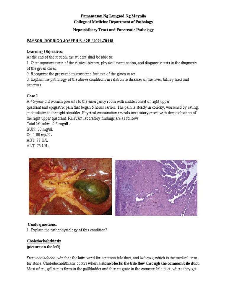 Hepatobiliary Tract and Pancreatic Pathology Assignment - PAYSON | PDF ...
