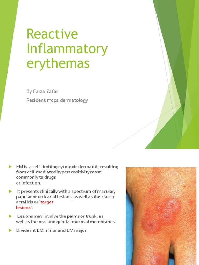 Reactive Inflammatory Erythemas | PDF | Inflammation | Monocyte