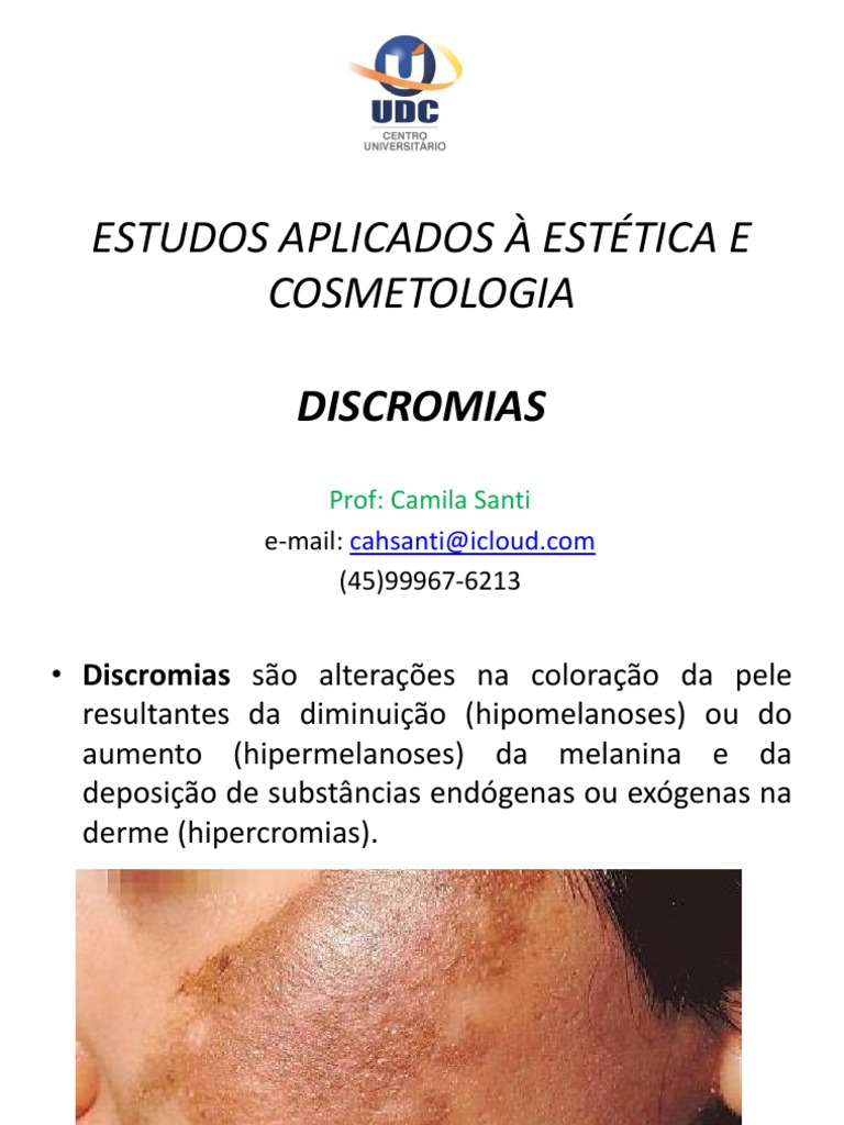 discromias aula | PDF | Pele | Sistema tegumentar
