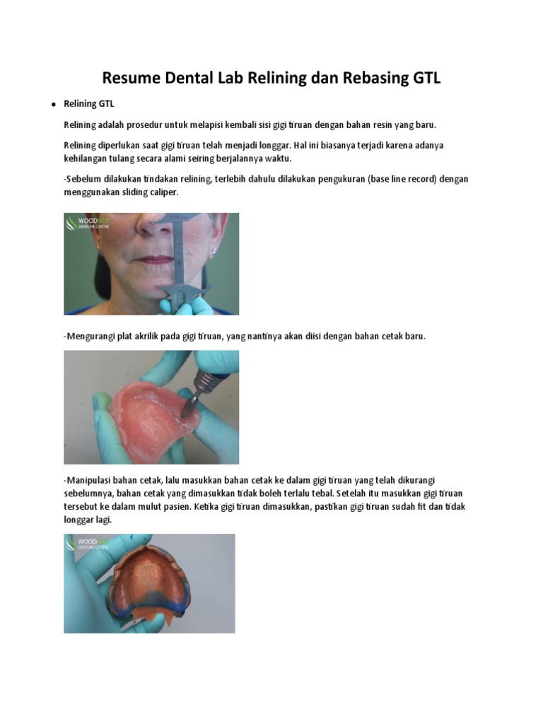 Resume Dental Lab Relining Dan Rebasing GTL | PDF