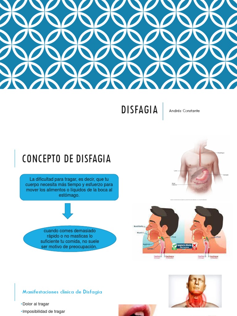 Concepto y tratamiento de disfagia | PDF | Endoscopia | Esófago