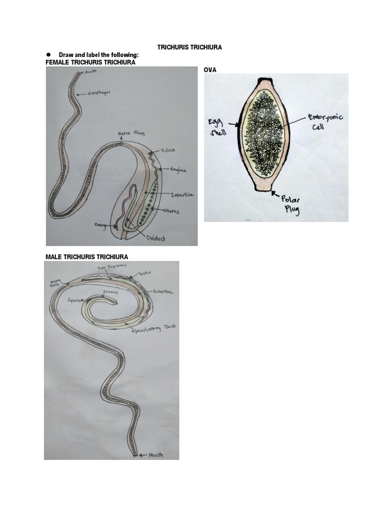 Trichuris Trichiura | PDF | Medical Specialties | Parasitology