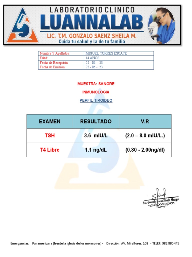 Miguel Torres Escate | PDF