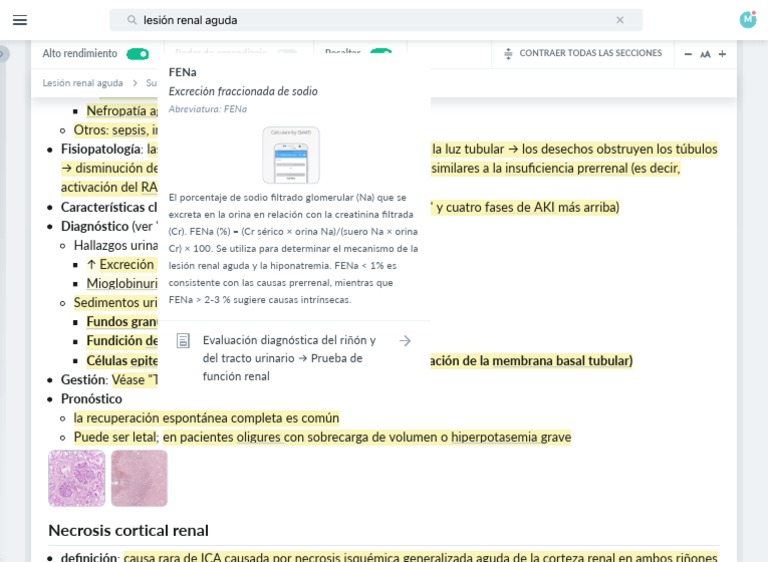 Lesión Renal Aguda - AMBOSS | PDF | Riñón | Causas de la muerte