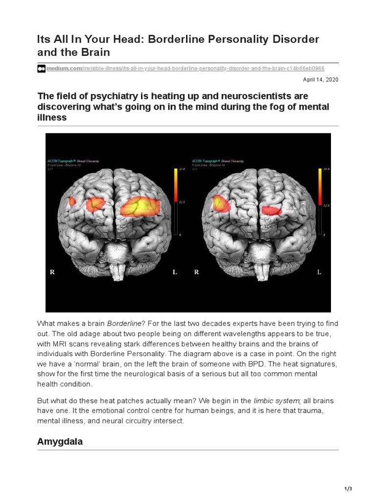 Its All in Your Head Borderline Personality Disorder and The Brain ...