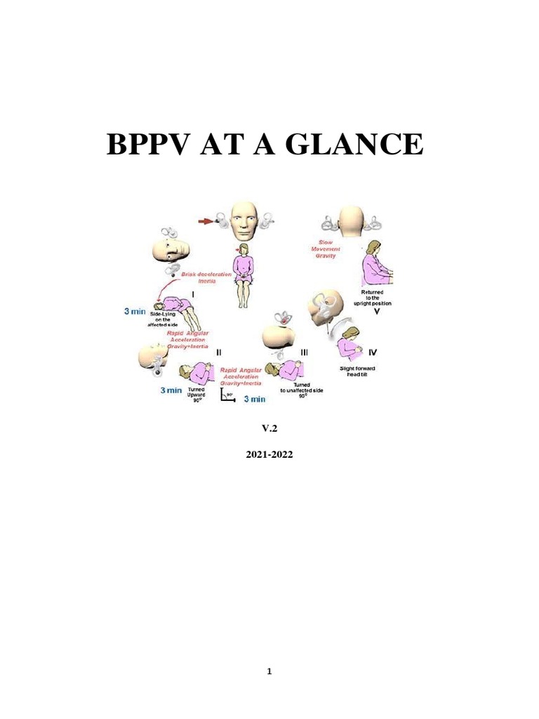 BPPV at A GLANCE 2022-Guide Book (Vestibuology) - 230330 - 083425 | PDF ...