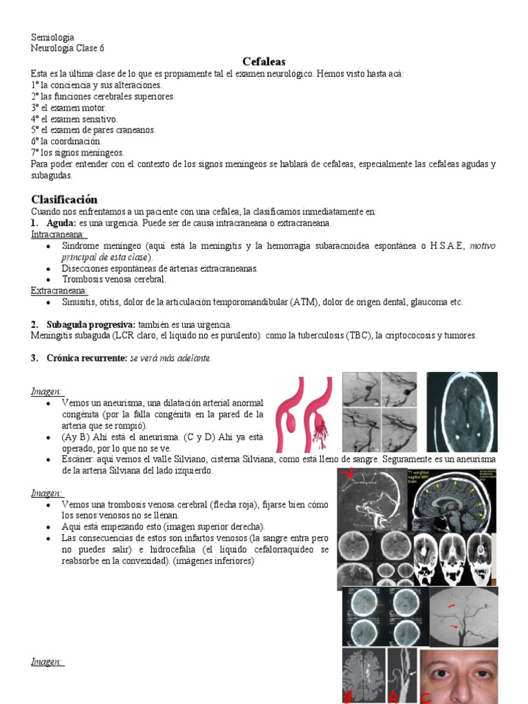 Clase 8 Cefalea Aguda | PDF | Meningitis | Fluido cerebroespinal