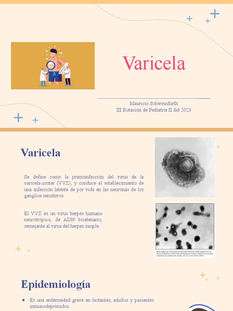 Varicela: Epidemiología y Tratamiento | PDF | Medicina CLINICA ...